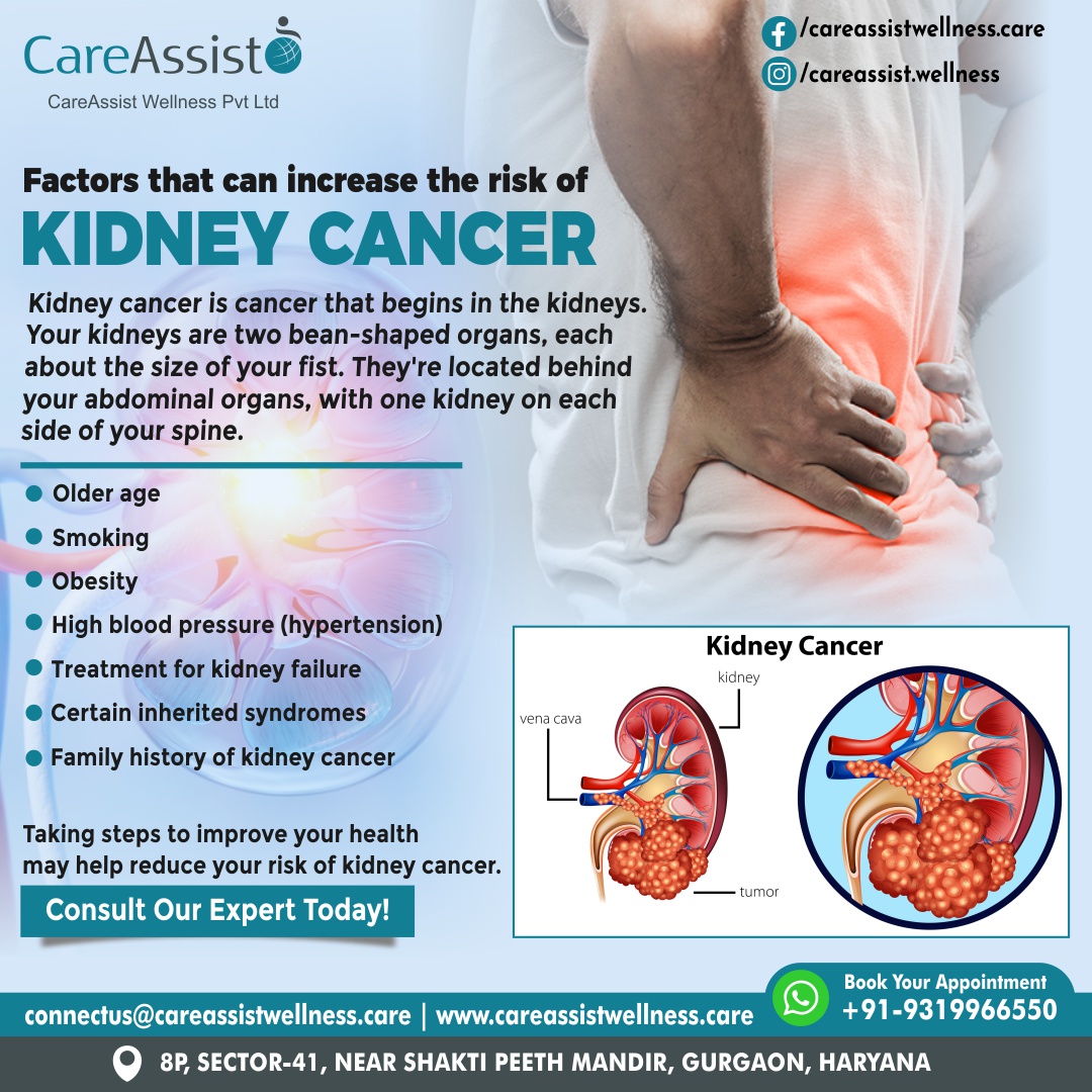 Understanding Kidney Transplant Cost in India: A Comprehensive Guide ...